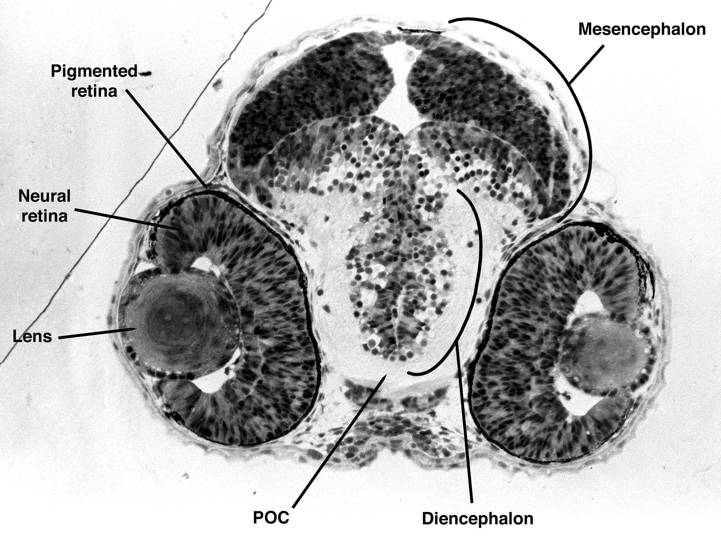 ZFIN 48 hrs lateral, picture 3