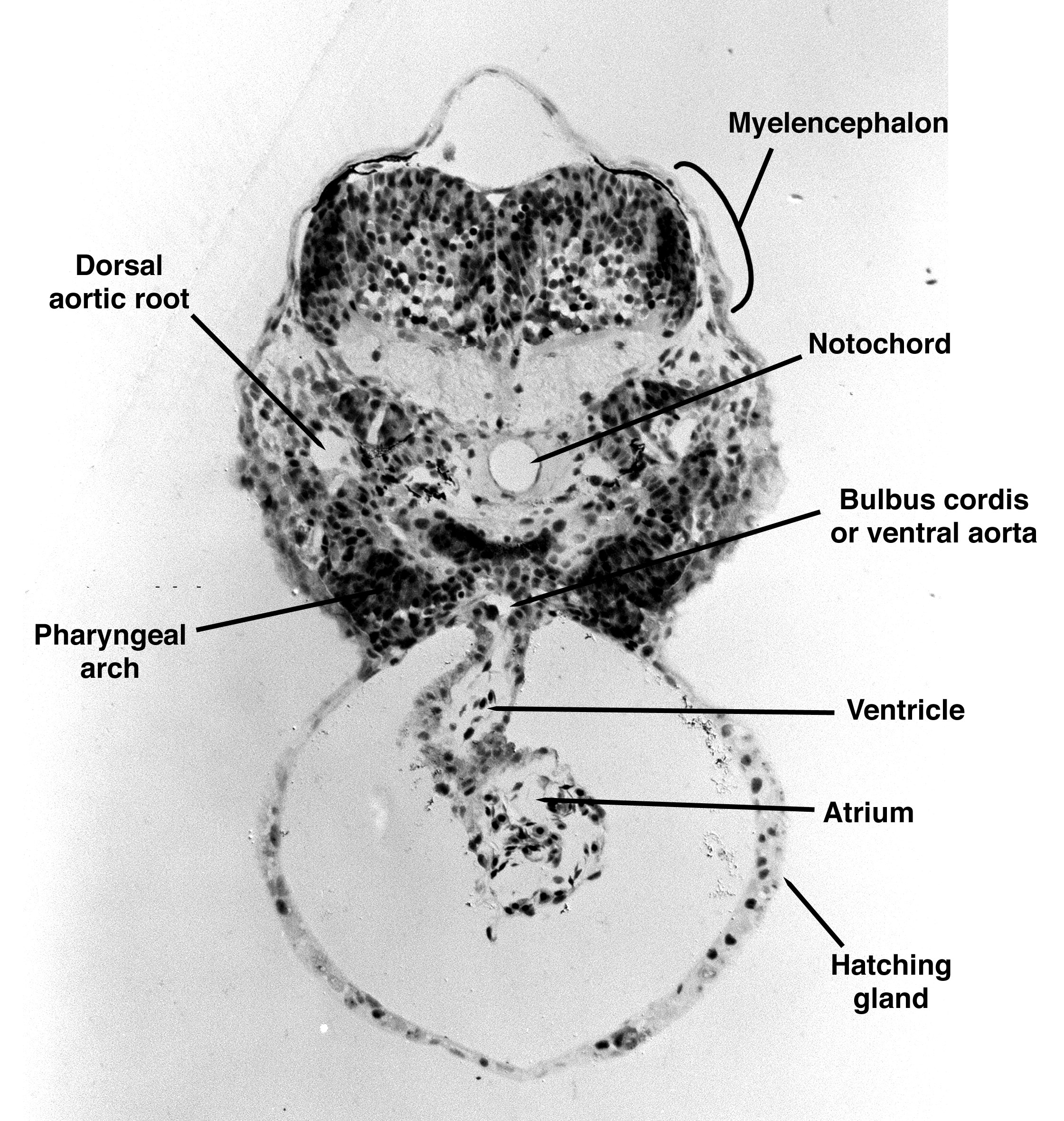 ZFIN 48 hrs lateral, picture 7