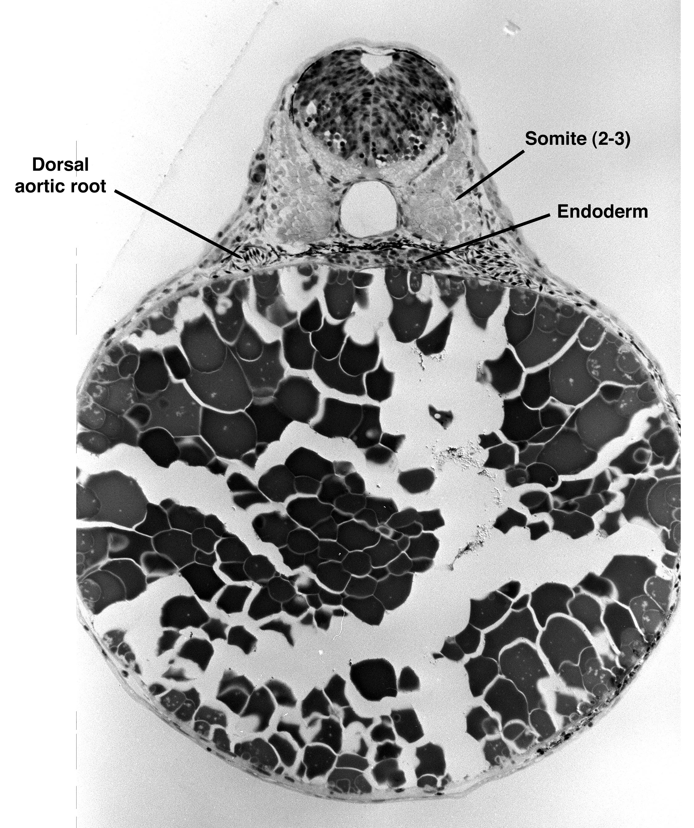 ZFIN 48 hrs lateral, picture 11