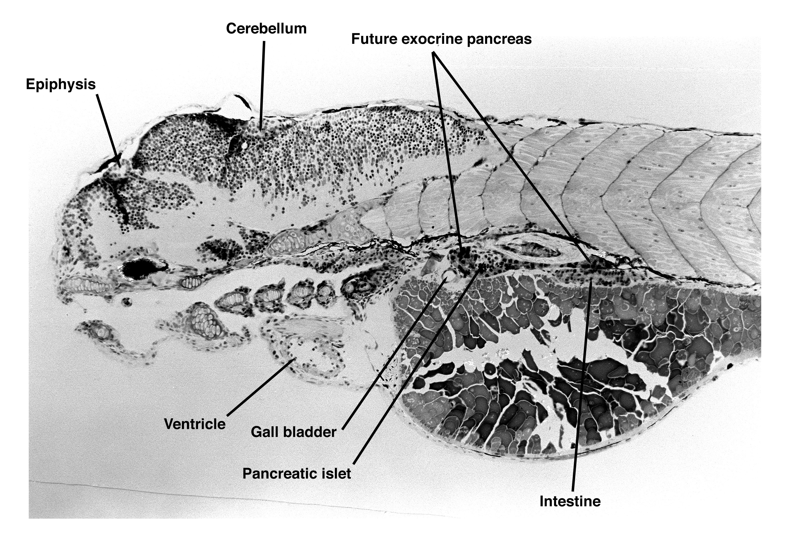 ZFIN 72 hrs dorsal, picture 1