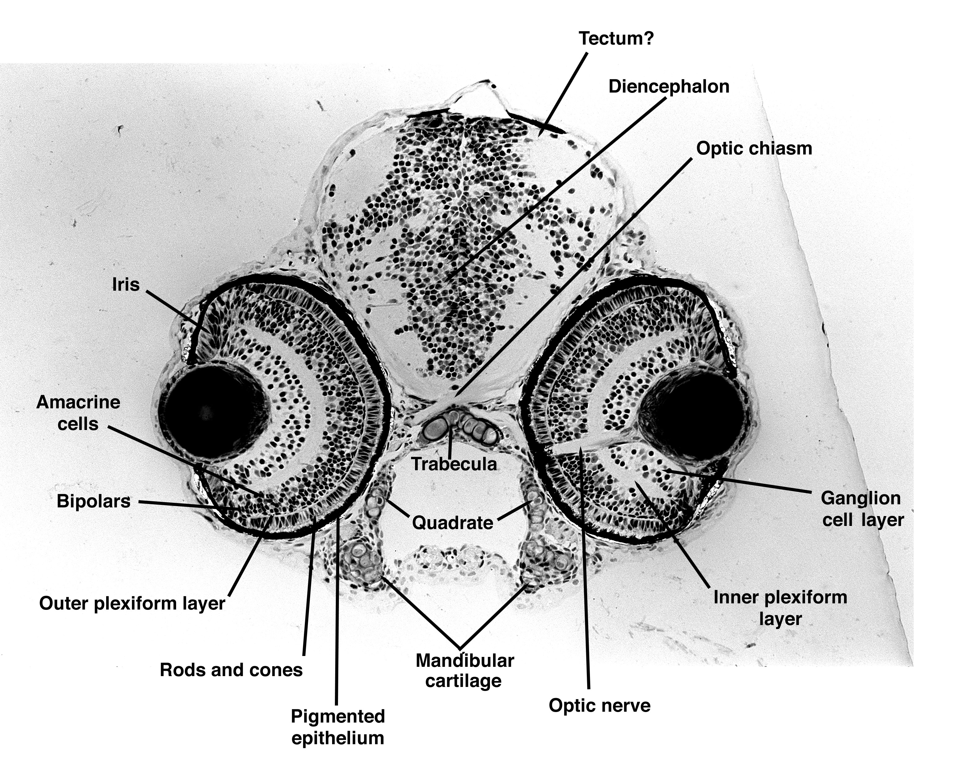 ZFIN 72 hrs lateral, picture 2