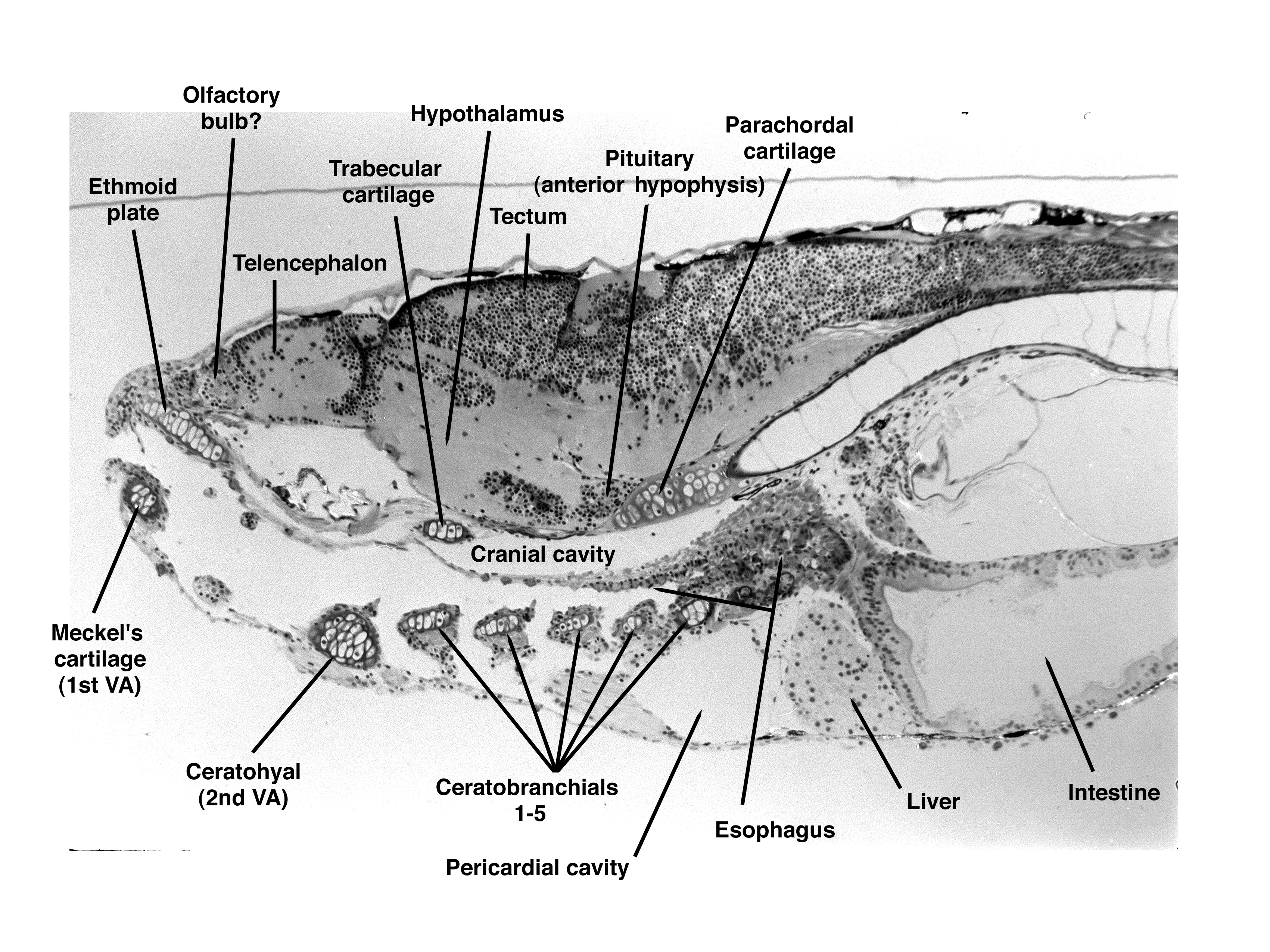 ZFIN 120 hrs dorsal, picture 3