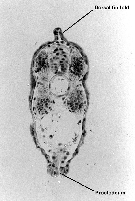 ZFIN 24 hrs lateral, picture 6