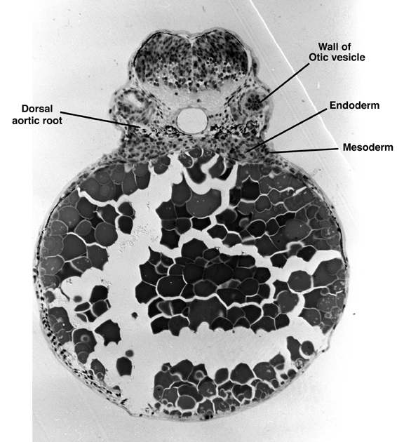 ZFIN 48 hrs lateral, picture 10